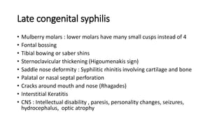 Congenital syphilis | PPTX