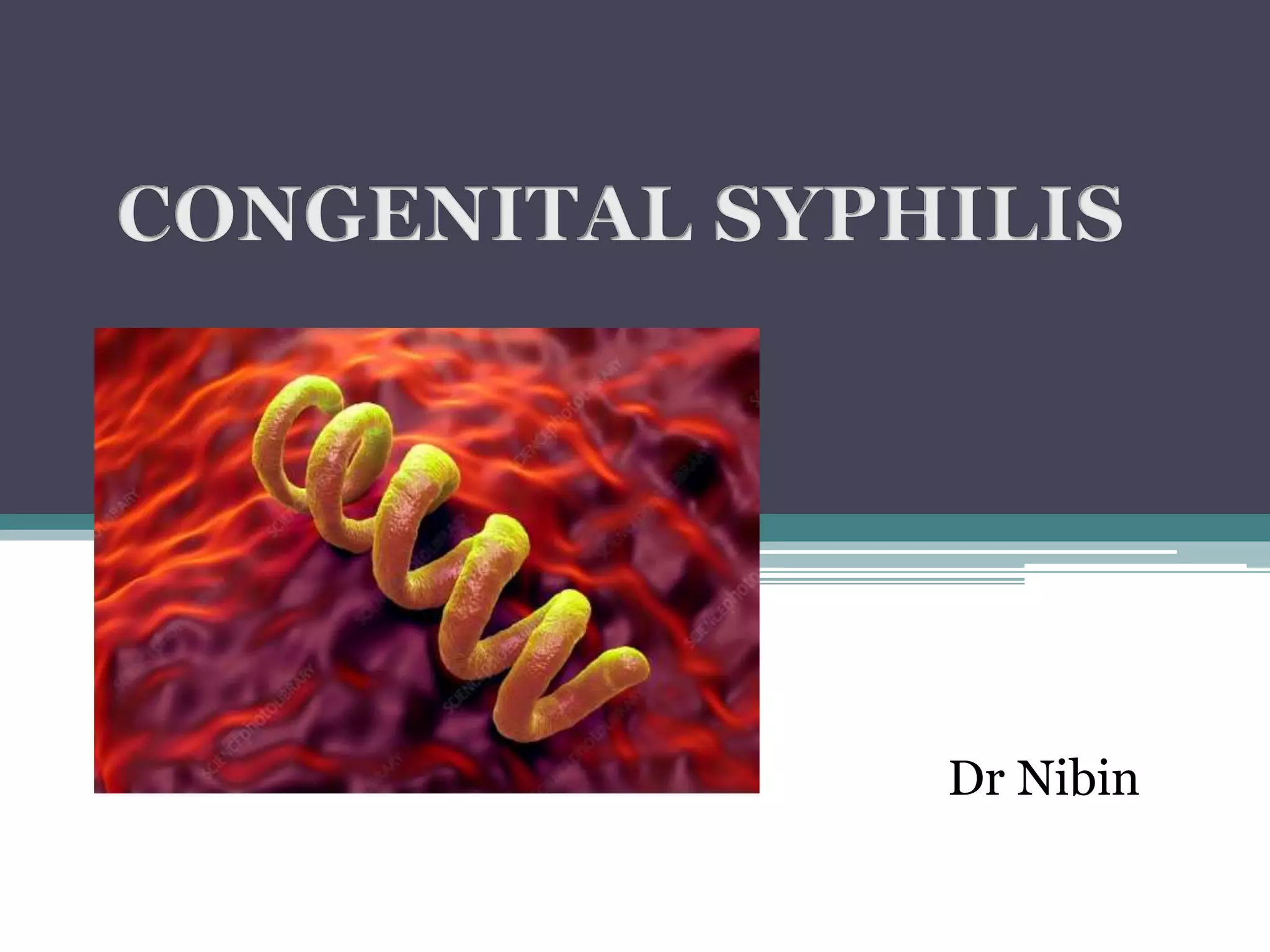 congenital syphilis.pptx