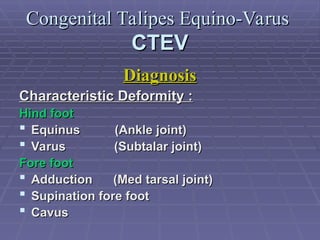 Congenital Talipes Equino-Varus.ppt Congenital Talipes Equino-Varus.ppt