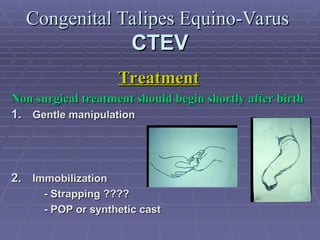 Congenital Talipes Equino-Varus.ppt Congenital Talipes Equino-Varus.ppt