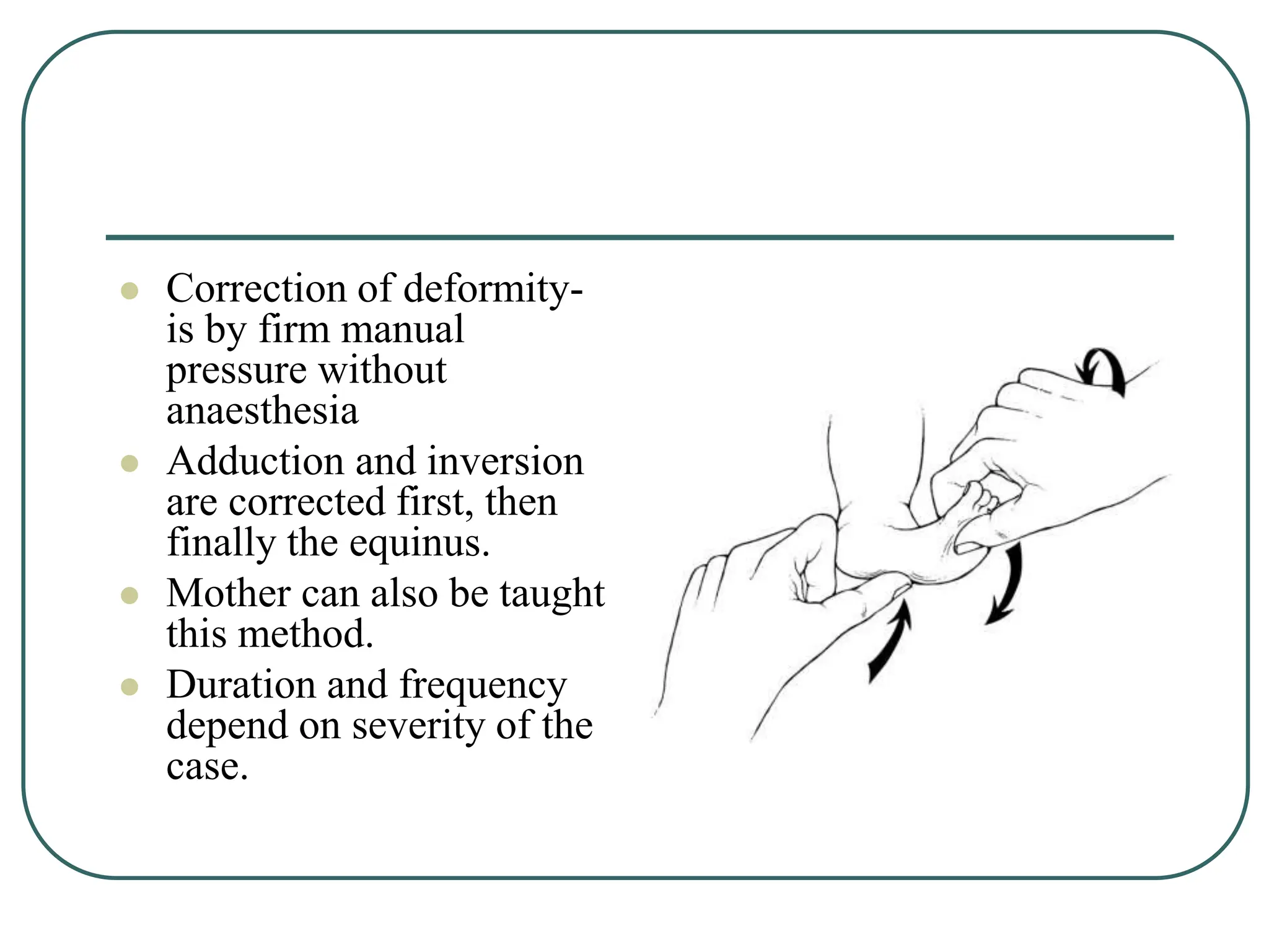 Congenital Talipes Equino Varus.pptjeiiieiu | PPT