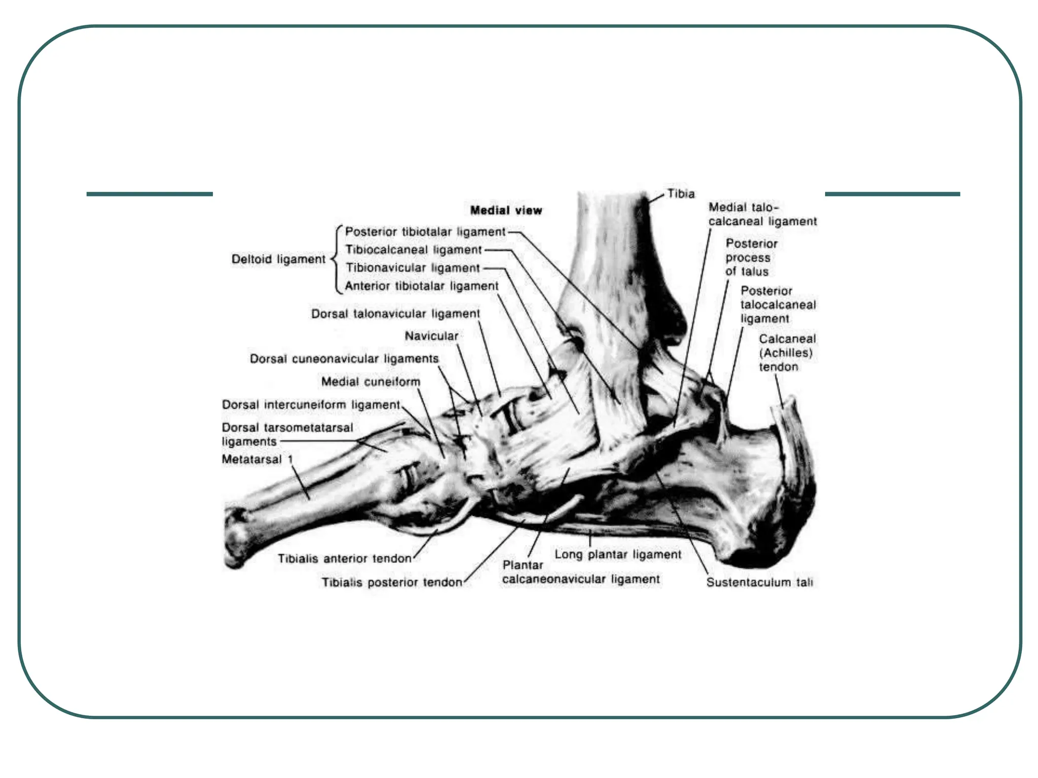 Congenital Talipes Equino Varus.pptjeiiieiu | PPT