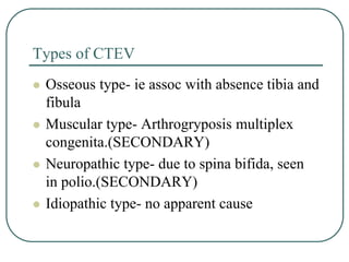 Congenital Talipes Equino Varus.pptjeiiieiu | PPT