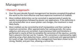 CONGENITAL TALIPES EQUINOVARUS (CLUBFOOT) Physiotherapy Dr. Apurva ...