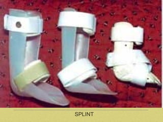 CONGENITAL TALIPES EQUINO VARUS & SPINA BIFIDA | PPT