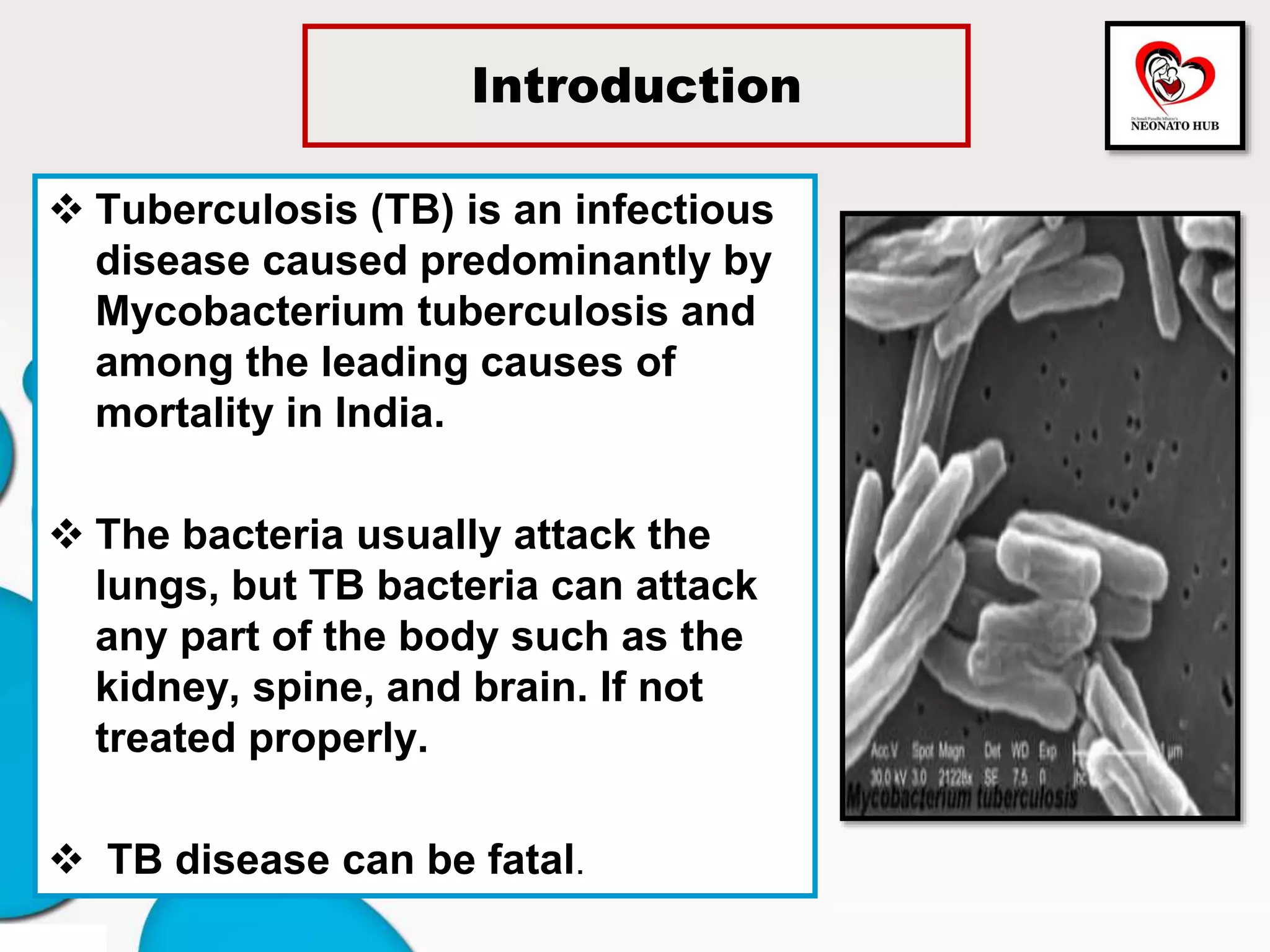 Congenital Tuberculosis (Updated in 2020) | PPT