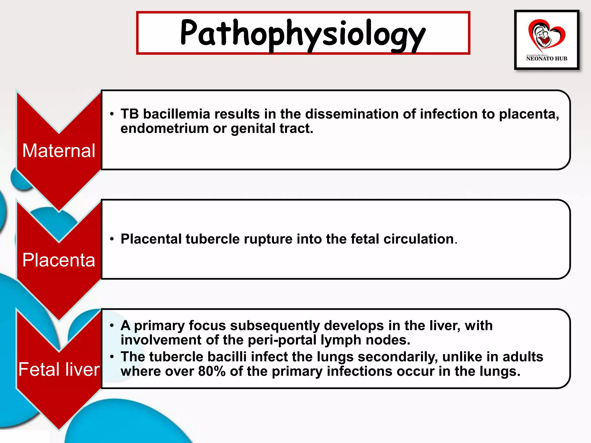 Congenital Tuberculosis (Updated in 2020) | PPT