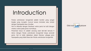 Congenital Urethrocutaneous Fistula (Journal Reading).pptx