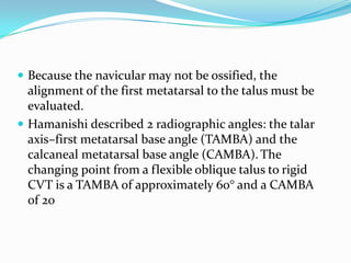Congenital vertical talus UG lecture | PPTX