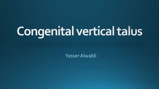 Congenital vertical talus | PPTX