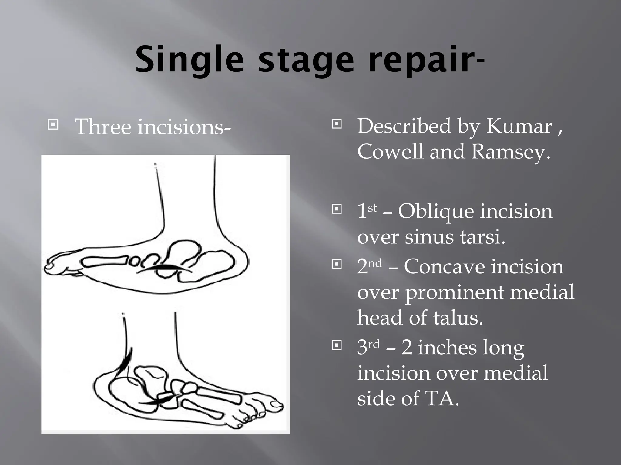 congenitalverticaltalus-160713182943.pptx