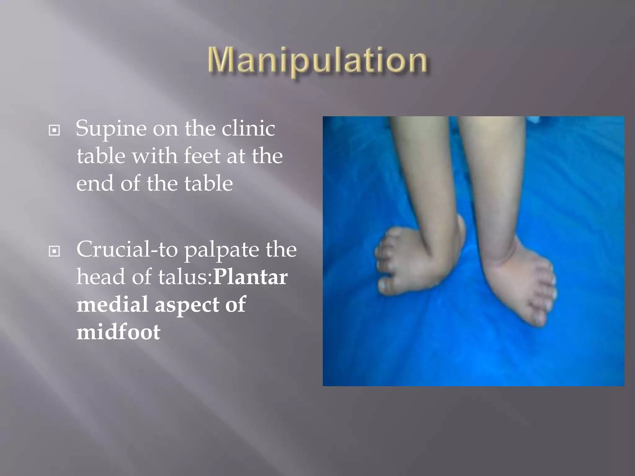 Congenital vertical talus | PPTX