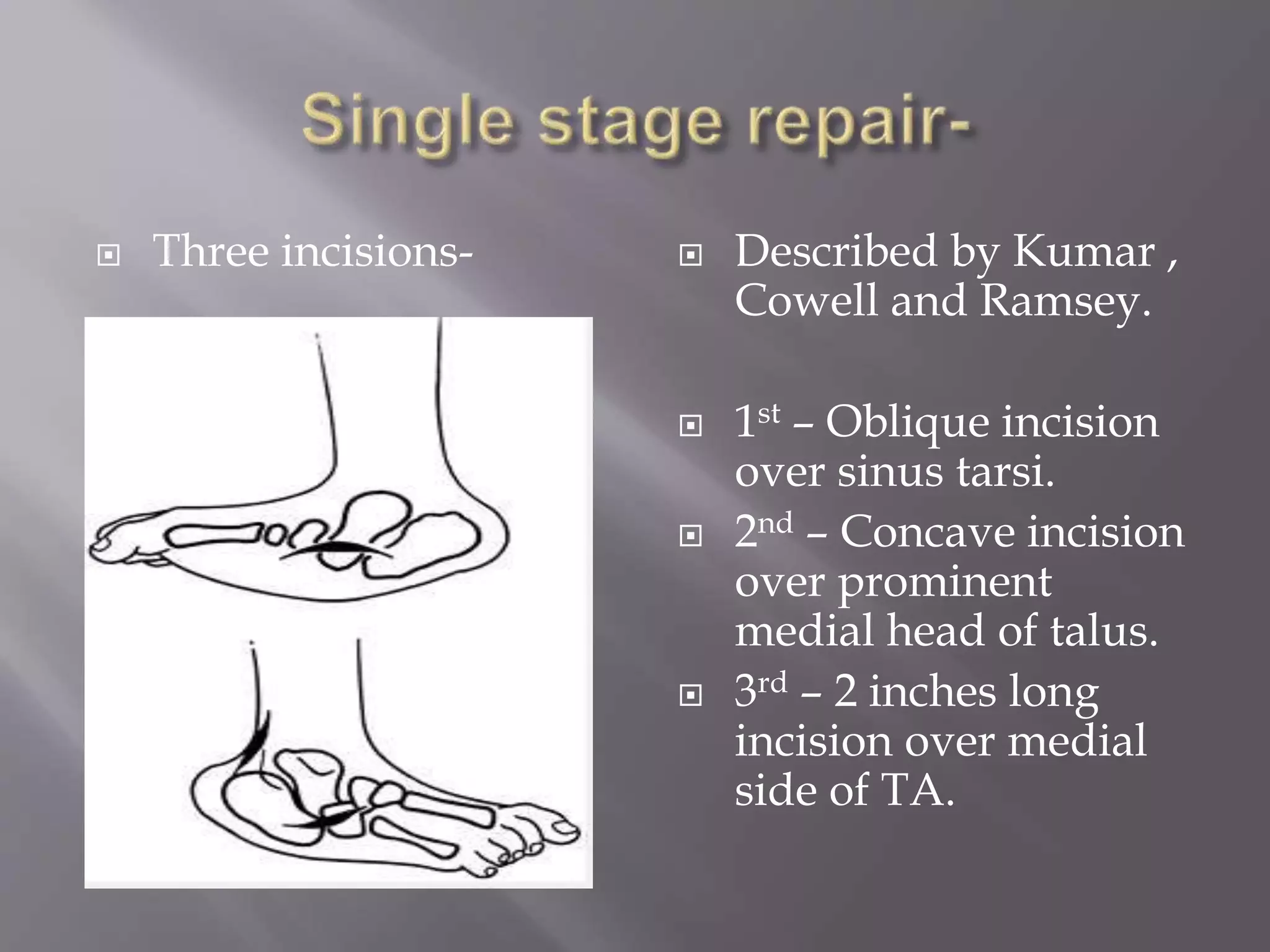 Congenital vertical talus | PPTX