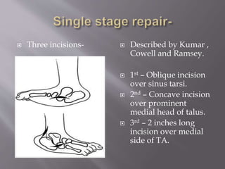 Congenital vertical talus | PPTX
