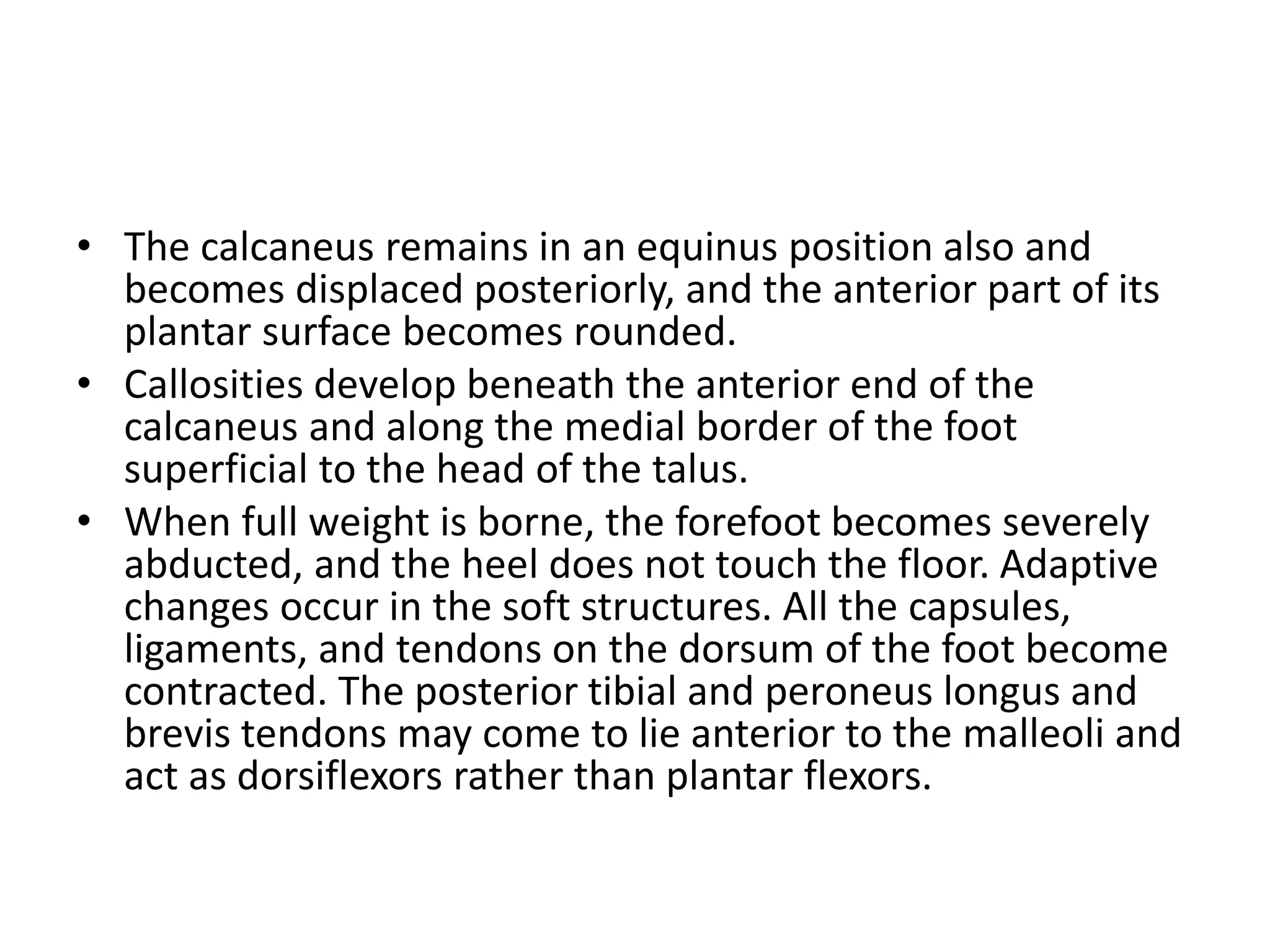 Congenital vertical talus | PPTX