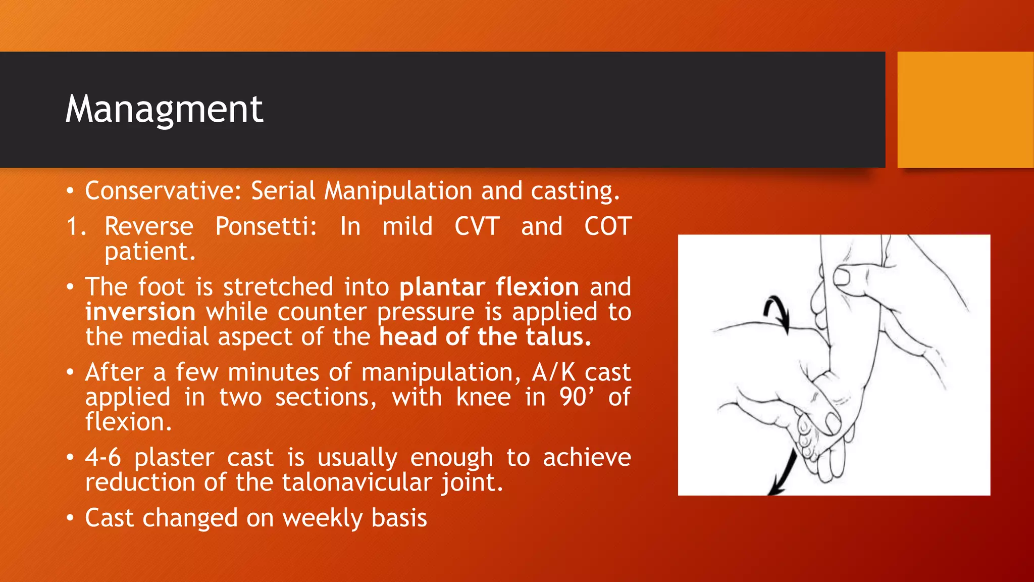 Congenital vertical talus | PPTX