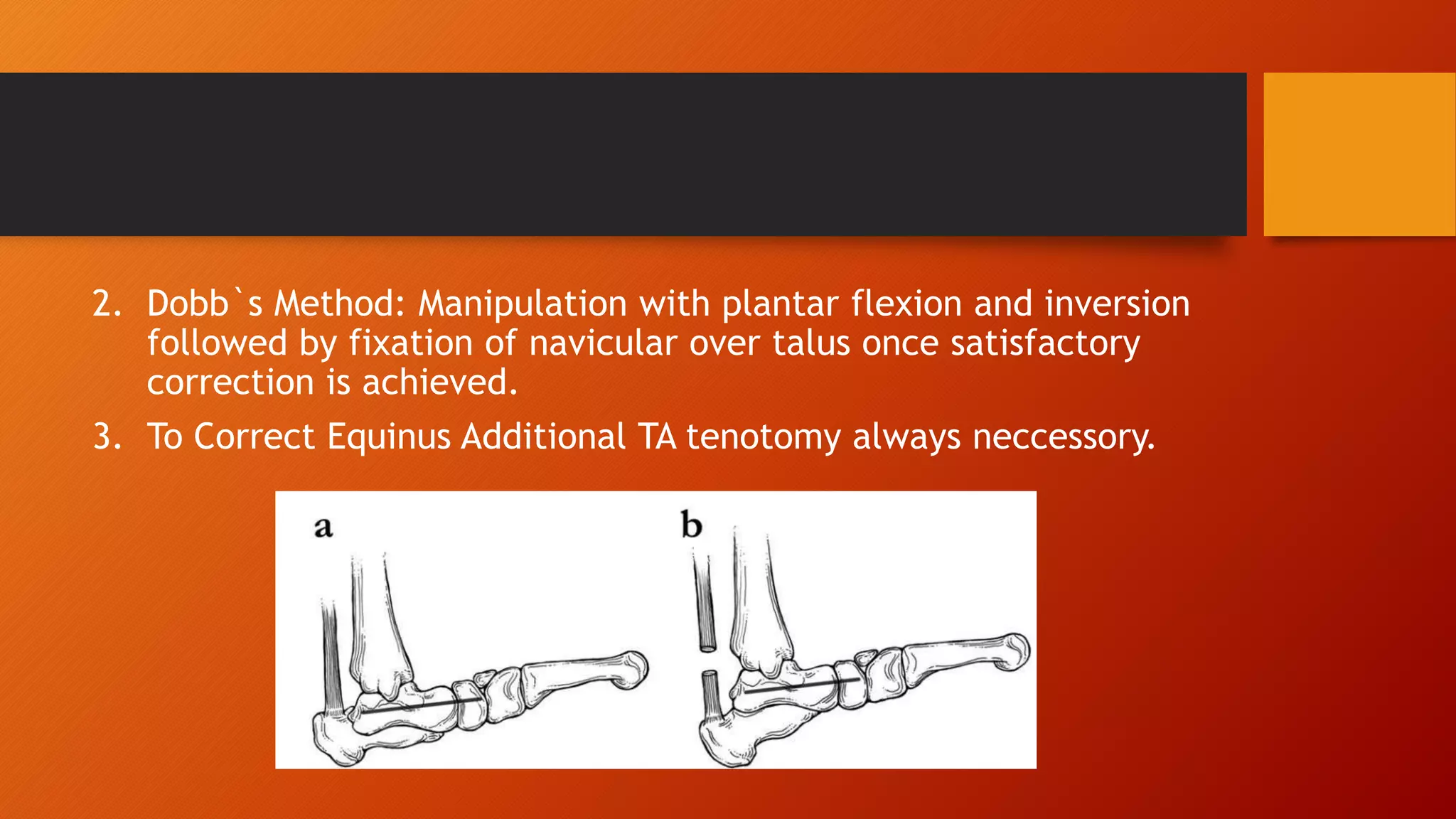 Congenital vertical talus | PPTX