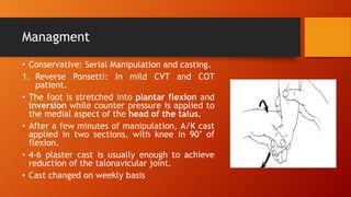 Congenital vertical talus | PPTX