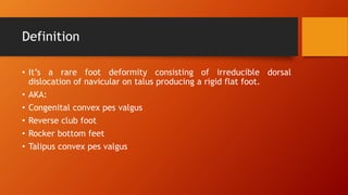Congenital vertical talus | PPTX