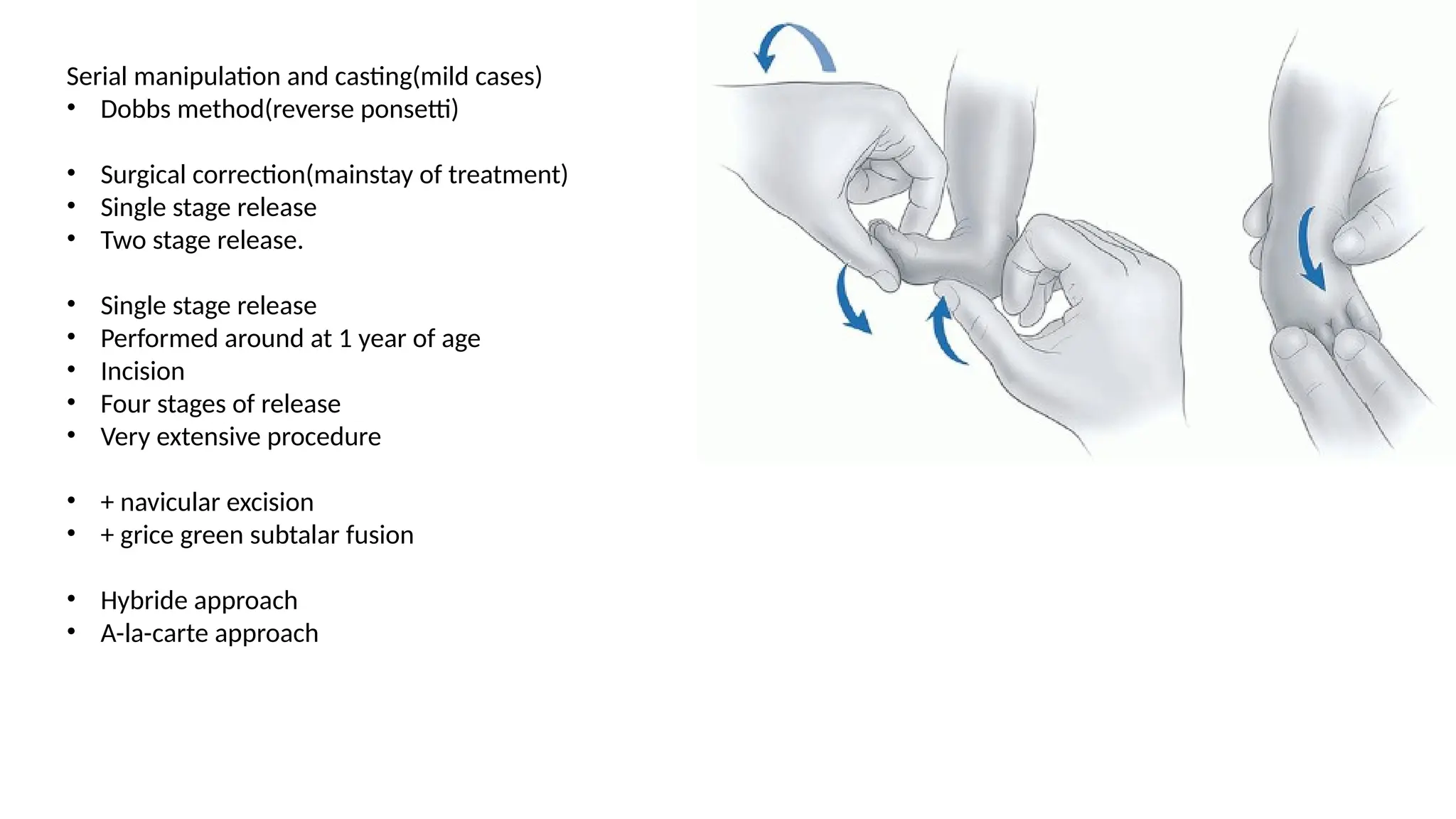 Congenital Vertical Talus: Clinical Presentation, Imaging, Etiology ...