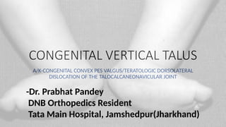 Congenital Vertical Talus: Clinical Presentation, Imaging, Etiology ...