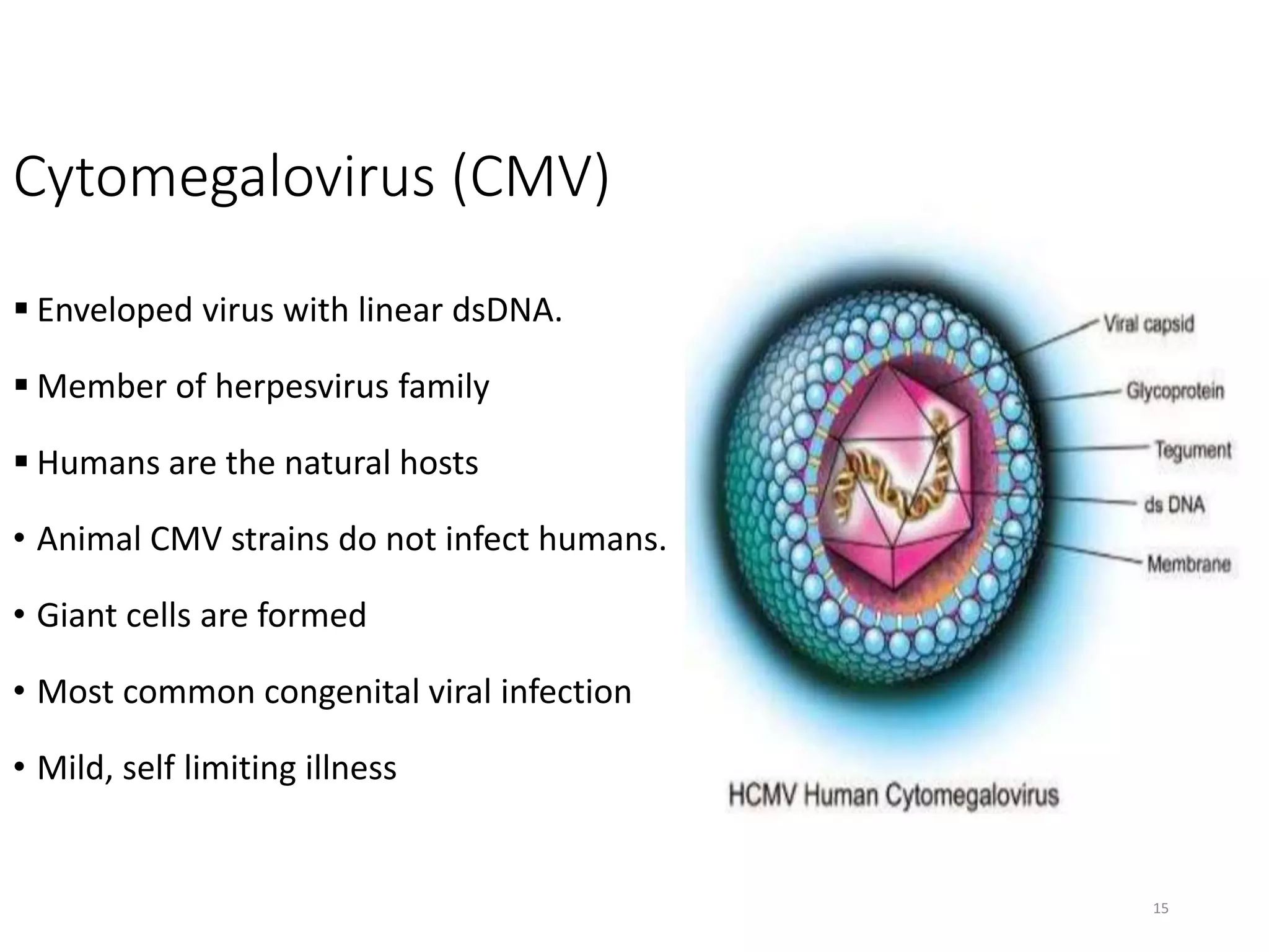CONGENITAL VIRAL INFECTION 2021.pptx