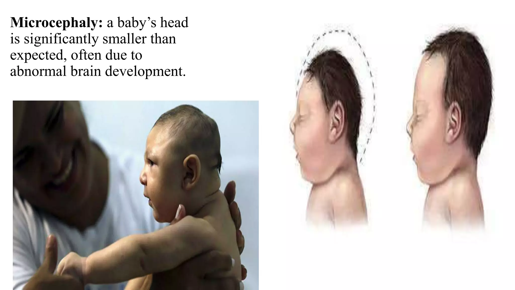 Congenital malformations | PPTX