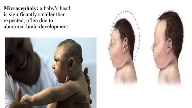 Congenital malformations | PPTX