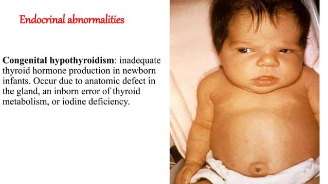Congenital malformations | PPTX