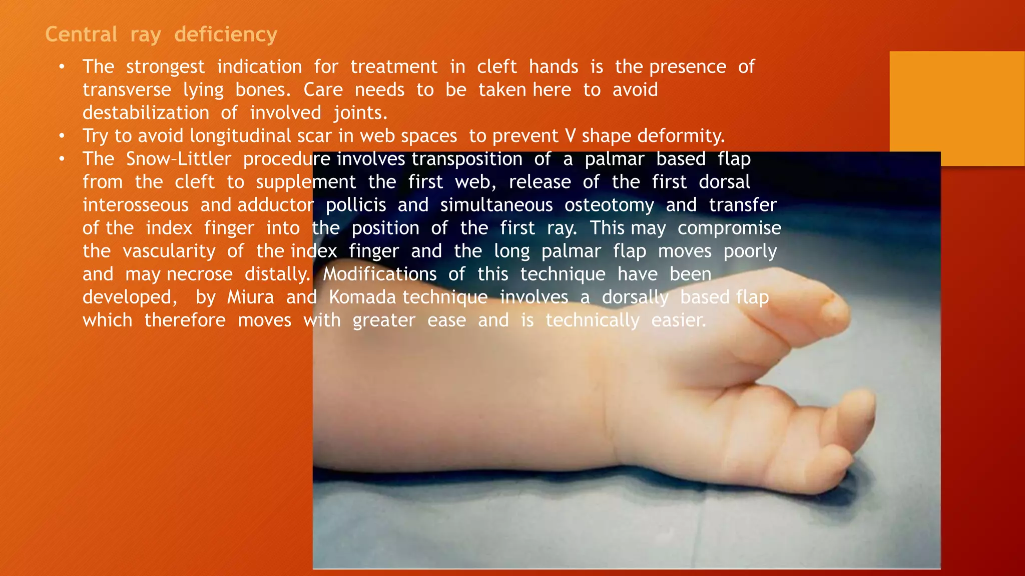 Congenital hand diseases: managment | PPTX