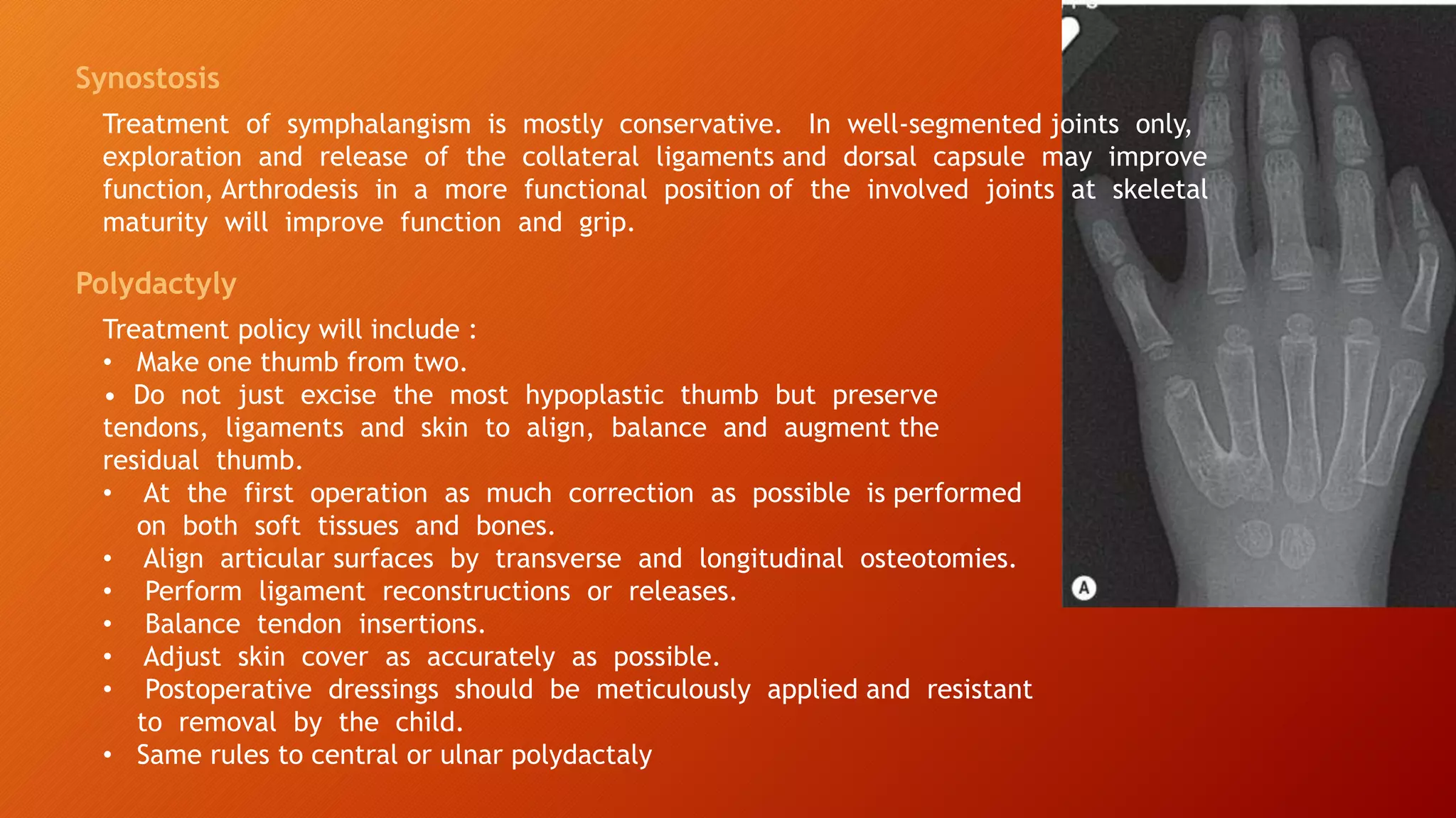 Congenital hand diseases: managment | PPTX