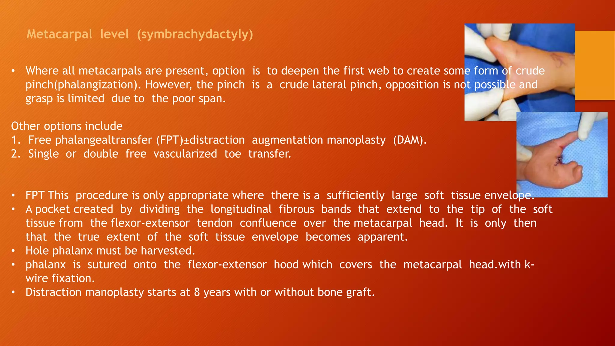 Congenital hand diseases: managment | PPTX