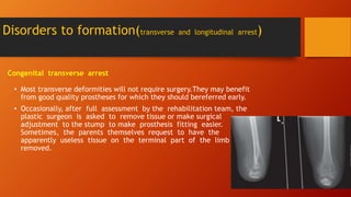 Congenital hand diseases: managment | PPTX