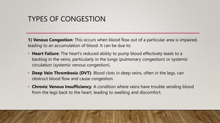 Congestion pathology for medical students | PPTX