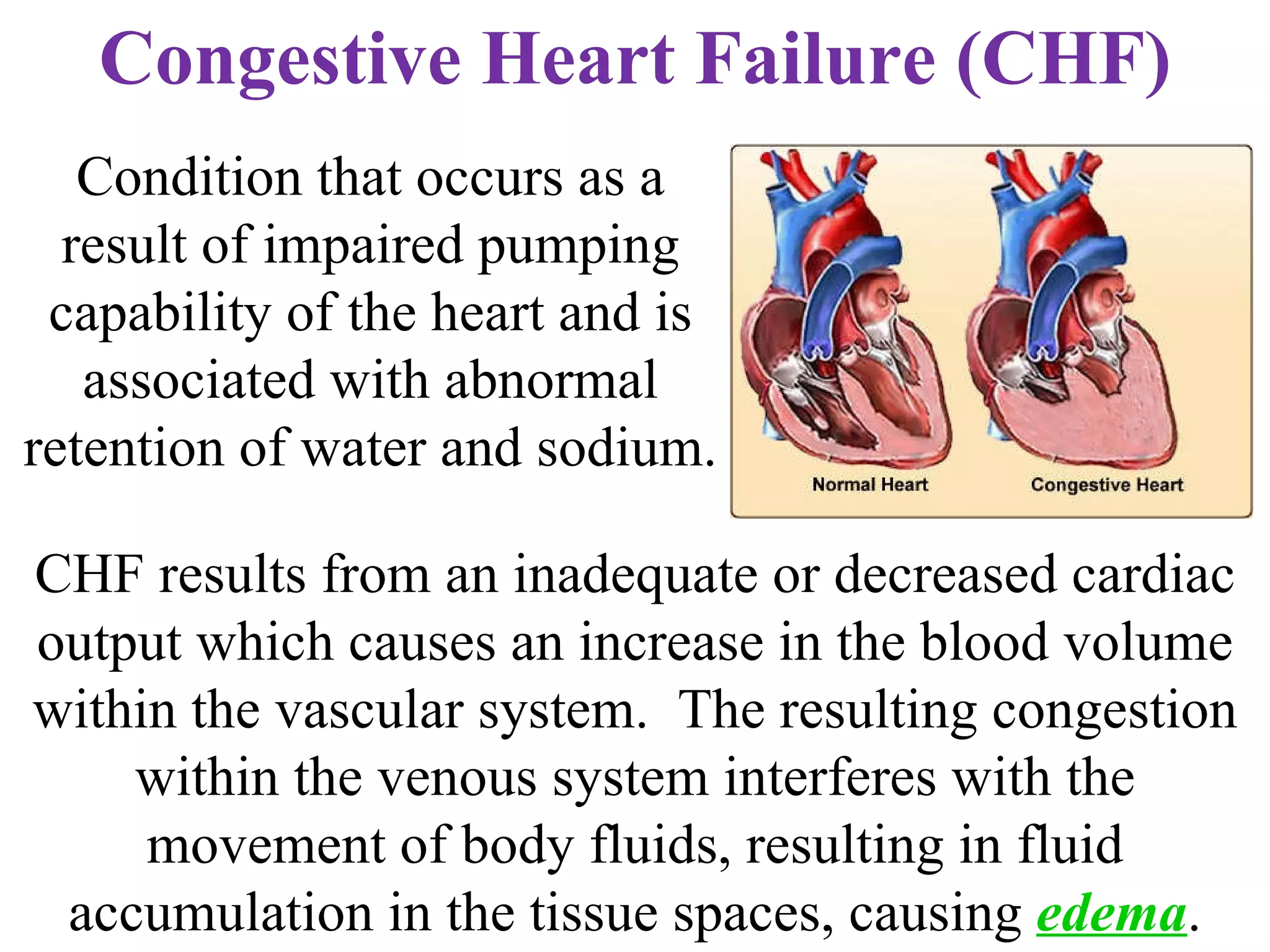 Congestive heart failure | PPT