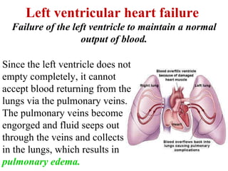 From Heart Failure Pulmonary Edema
