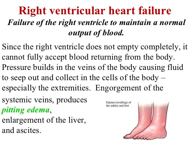Congestive heart failure