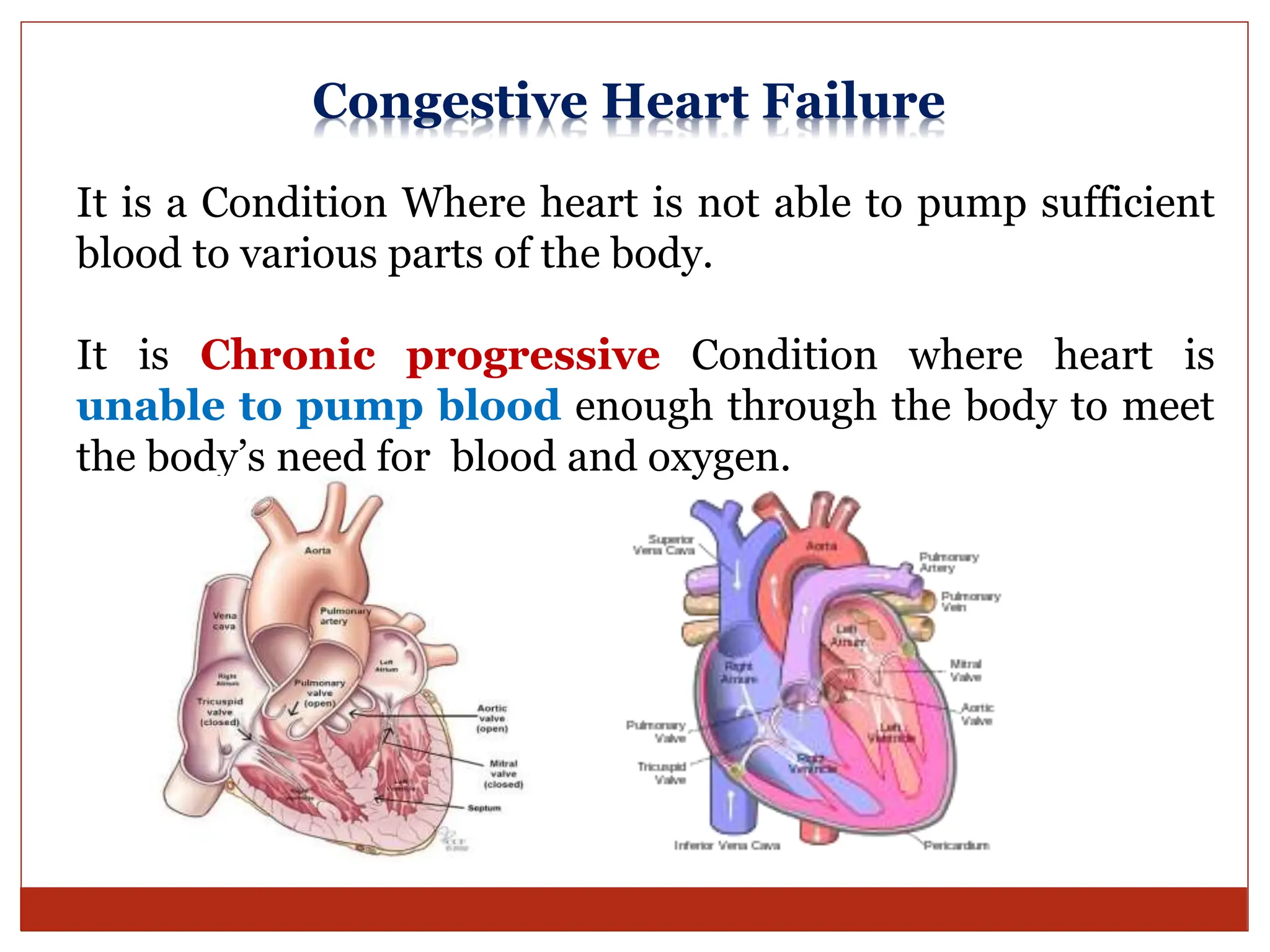 CONGESTIVE HEART FAILURE.pptx