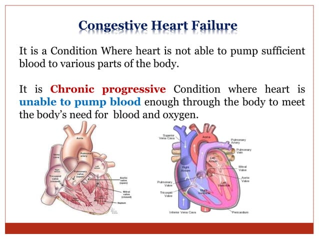CONGESTIVE HEART FAILURE.pptx | Heart and Cardiovascular Diseases | Diseases and Conditions
