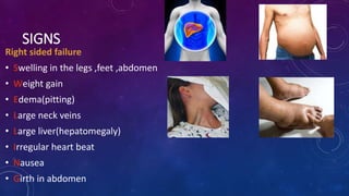 CONGESTIVE HEART FAILURE.pptx slides by laila | PPTX
