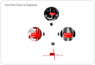 Congestive heart failure | PPTX