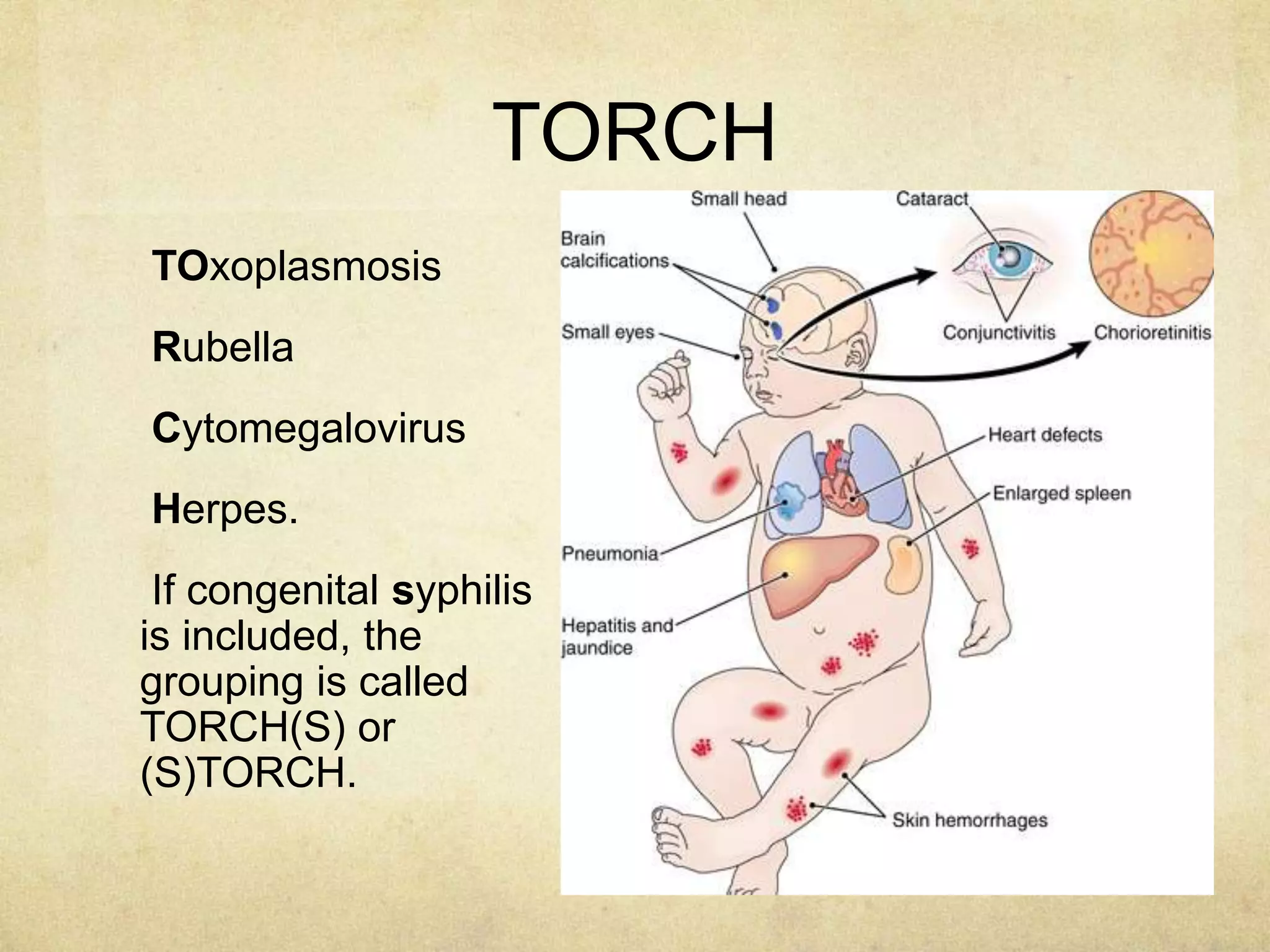 Congenital, Acquired Pyogenic, and Acquired Viral Infection | PPTX