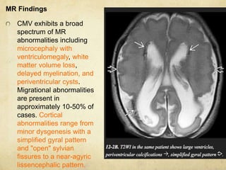 Congenital, Acquired Pyogenic, and Acquired Viral Infection | PPTX ...