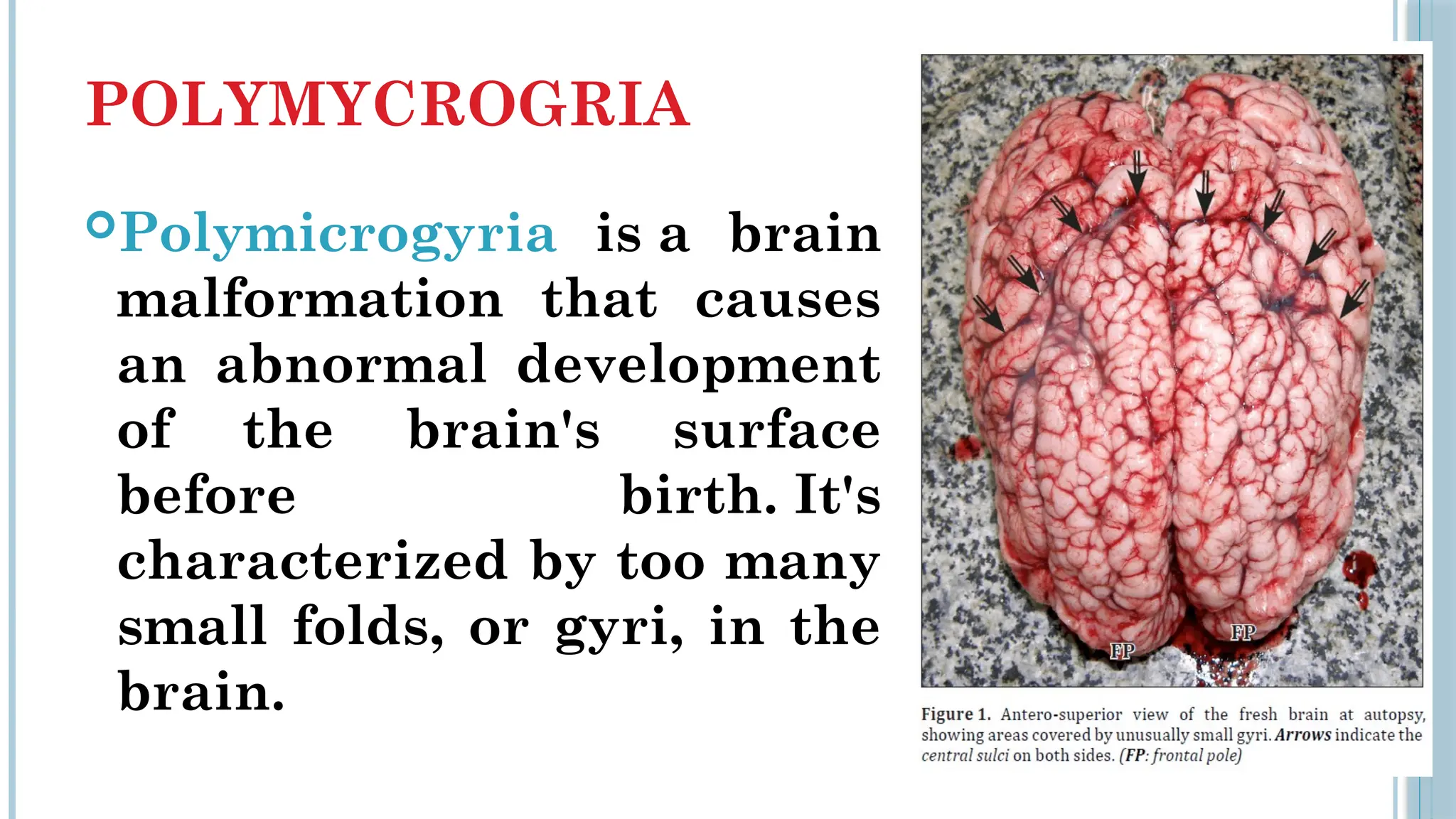 Congenital malformations, malformations at birth. | PPTX