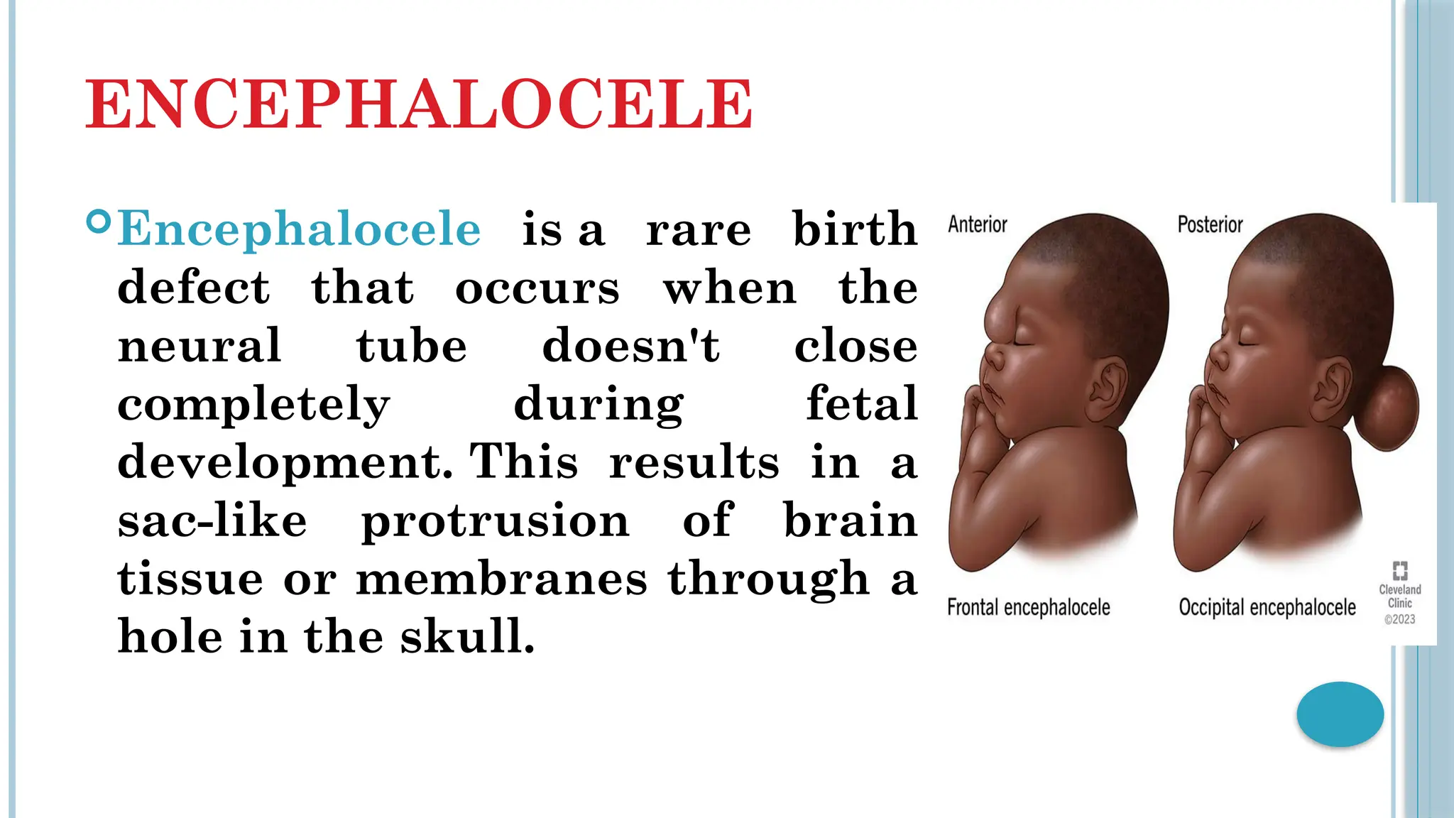 Congenital malformations, malformations at birth. | PPTX