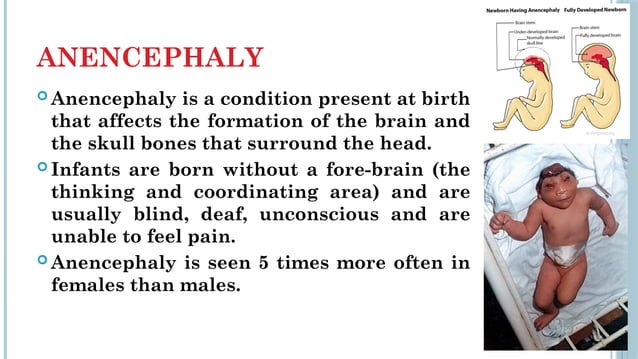 Congenital malformations, malformations at birth. | PPTX