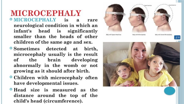 Congenital malformations, malformations at birth. | PPTX