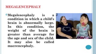 Congenital malformations, malformations at birth. | PPTX