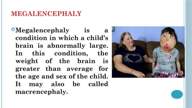 Congenital malformations, malformations at birth. | PPTX