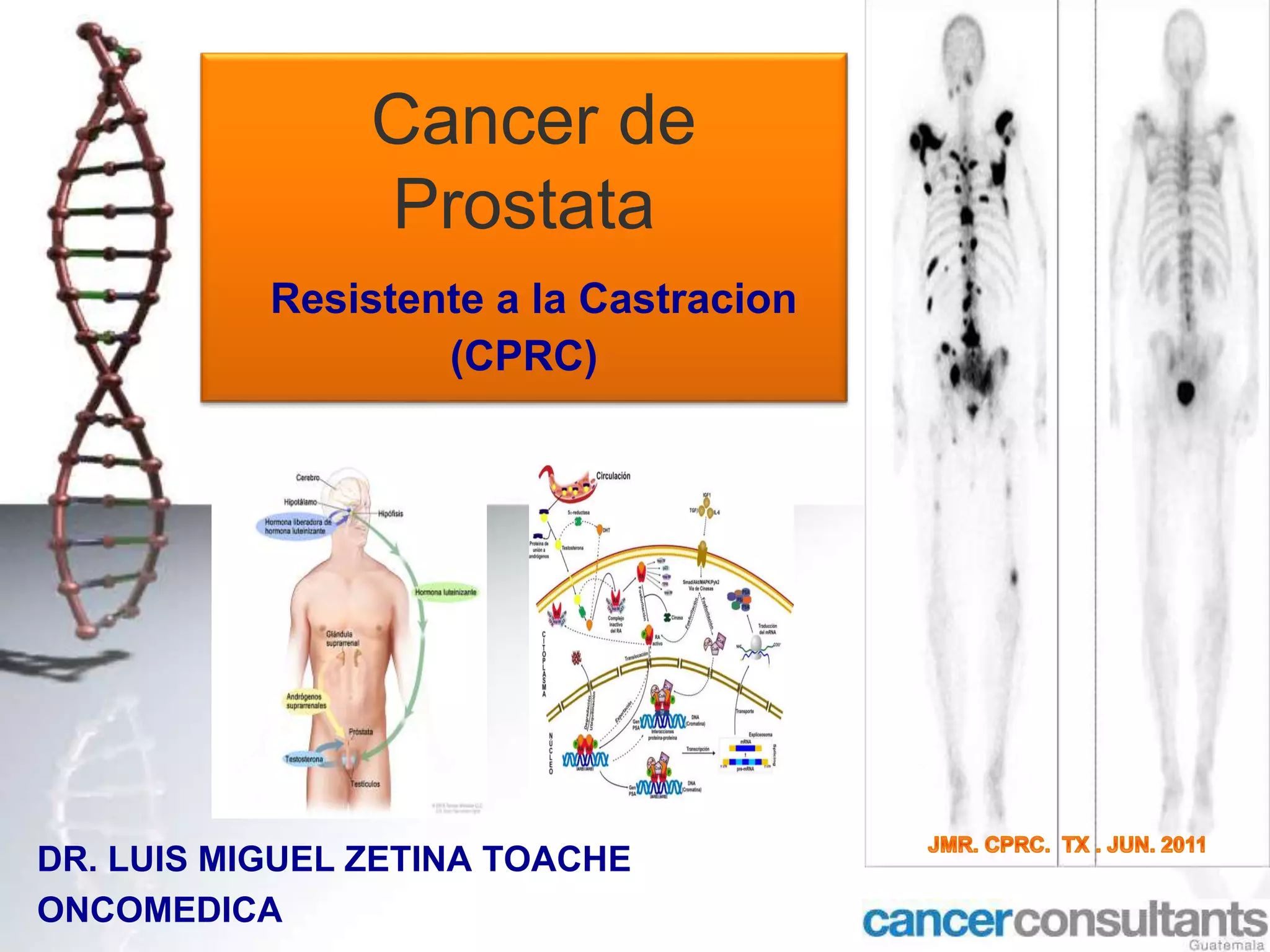 Prostate Cancer . Castration resistance | PPTX